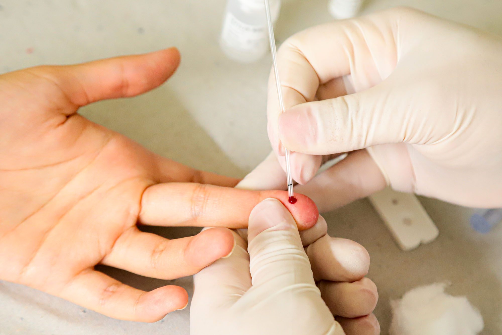 AMDIC de Santa Bárbara registra 20 mil atendimentos e procedimentos em ...